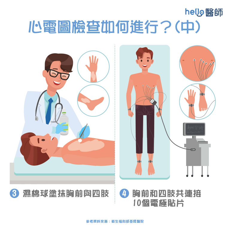 心電圖怎麼看？波型判讀及檢查流程介紹 Hello 醫師