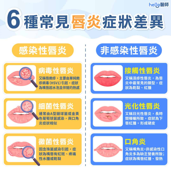 唇炎是什麼？唇炎分2種，症狀原因大不同！治療藥膏完整看