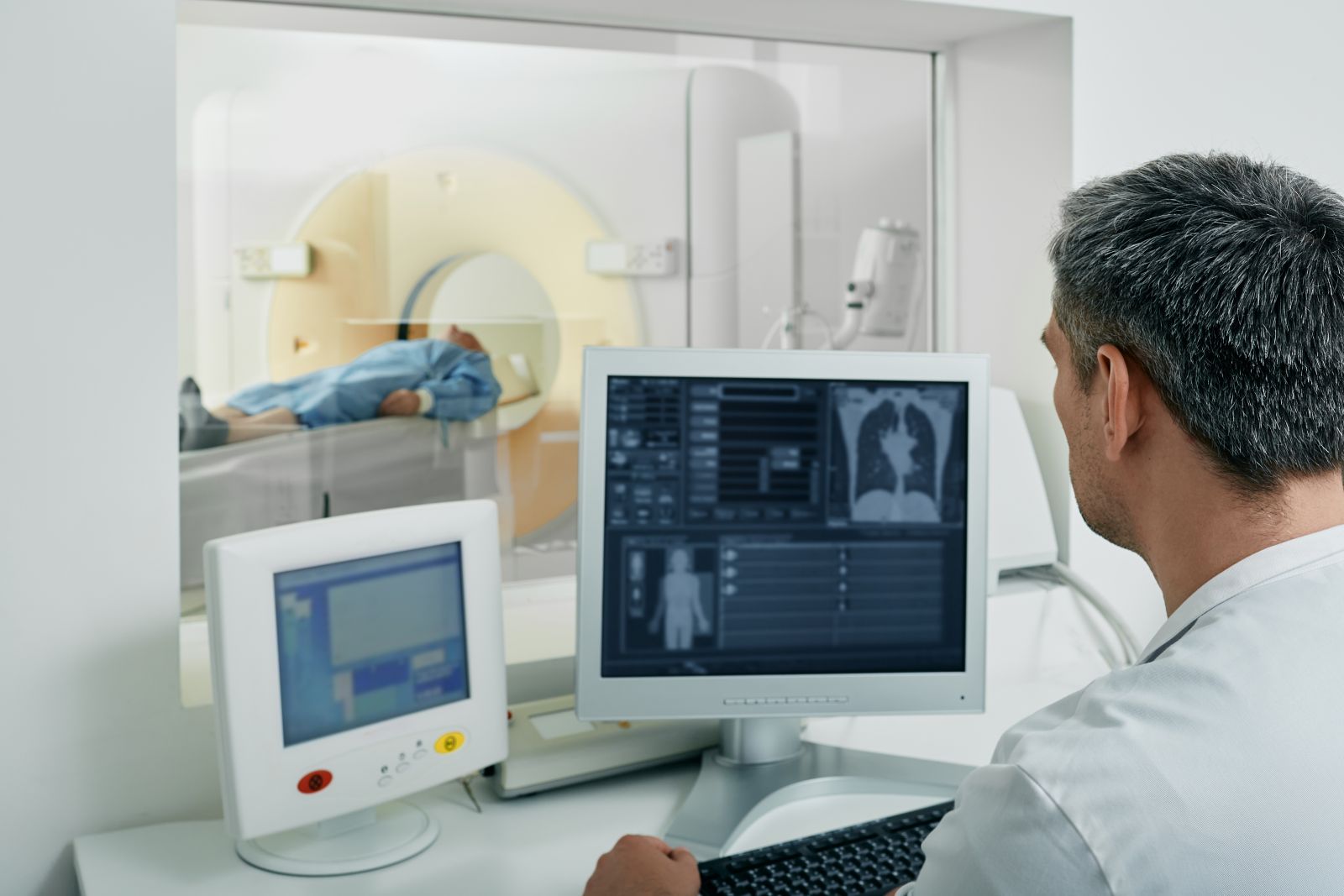 低劑量肺部電腦斷層多少錢？LDCT篩檢補助、肺結節追蹤一次懂